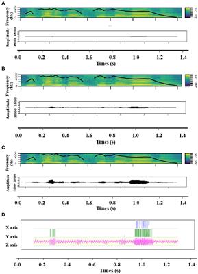 Frontiers | Influence of bodily resonances on emotional prosody perception